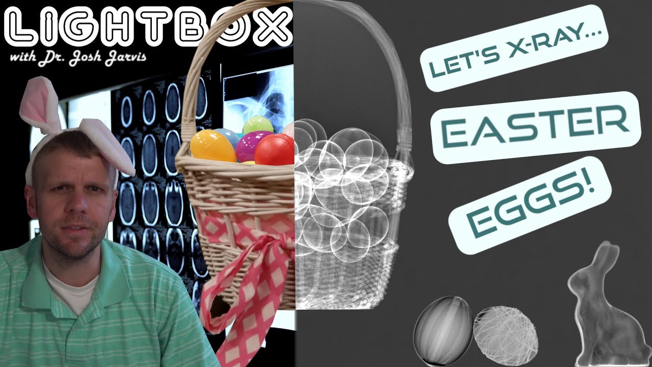 Let's X-ray... Easter Eggs! - YouTube