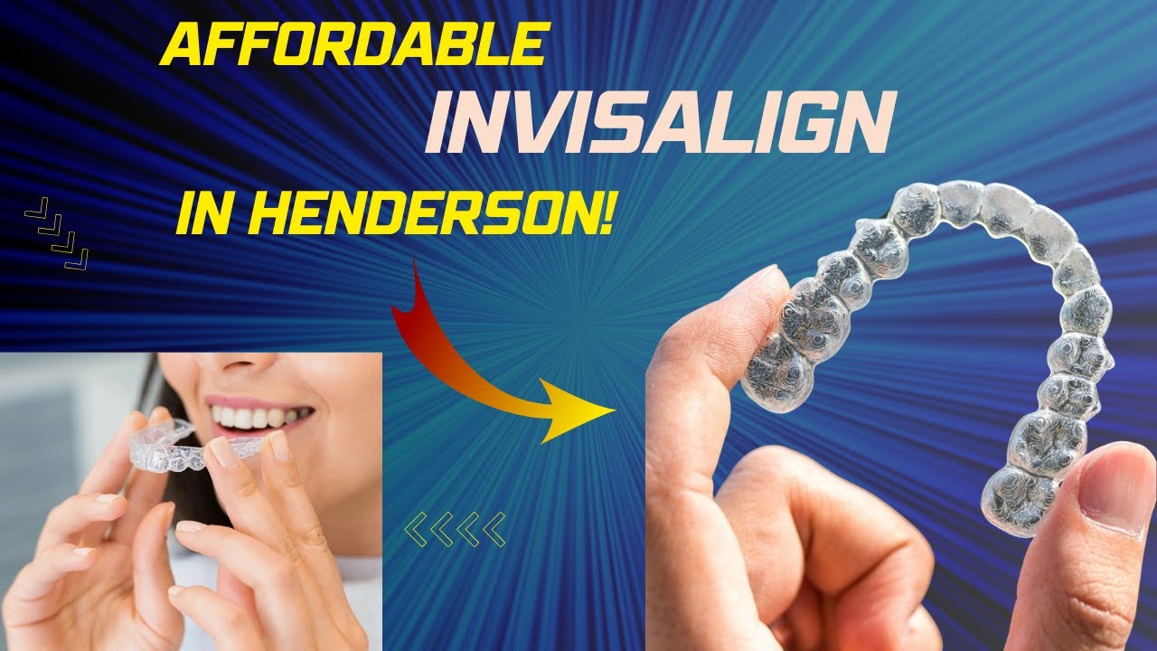 Affordable invisalign quotes Henderson NV l 702-825-7447 l Best ...