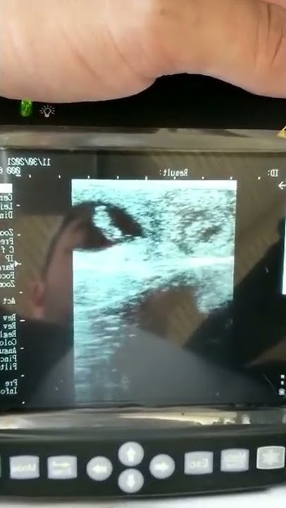 Kaixin KX5200 - YouTube