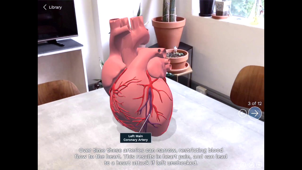 JigSpace: See how a heart stent works in augmented reality - YouTube