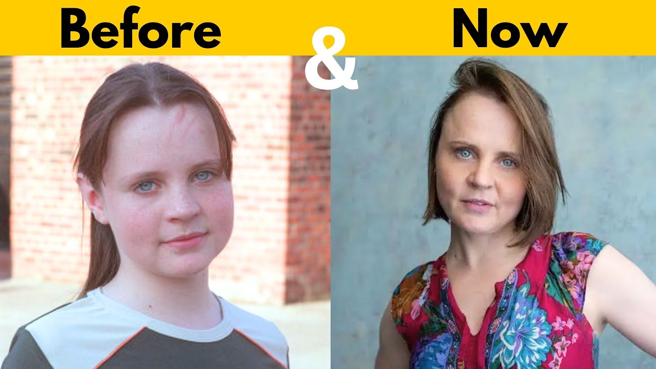 Children’s Ward Cast - Before Vs Now - YouTube