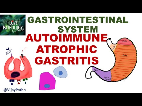 How Does Autoimmune Gastritis Lead To Hypergastrinemia