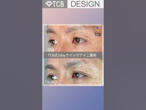 【TCB式1dayクイックアイ】左右差を撃退！#shorts - YouTube