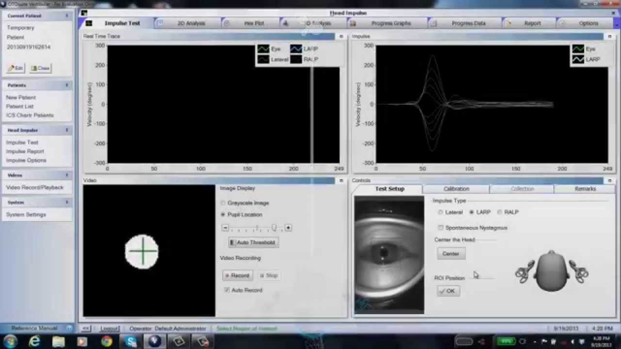 ICS Impulse - Performing LARP RALP head impulses - YouTube