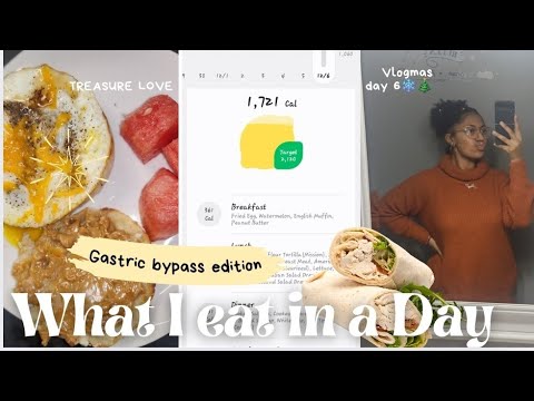 Over- Eating as a Gastric Bypass patient, post 10 months | calorie ...