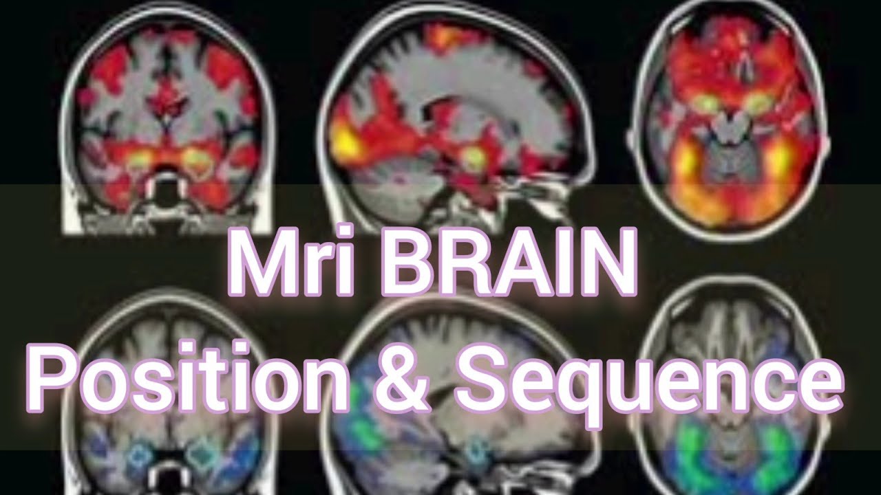 RAPID MODE!!! MRI BRAIN!! NON CONTRAST!!! SEQUENCE & POSITION step by ...