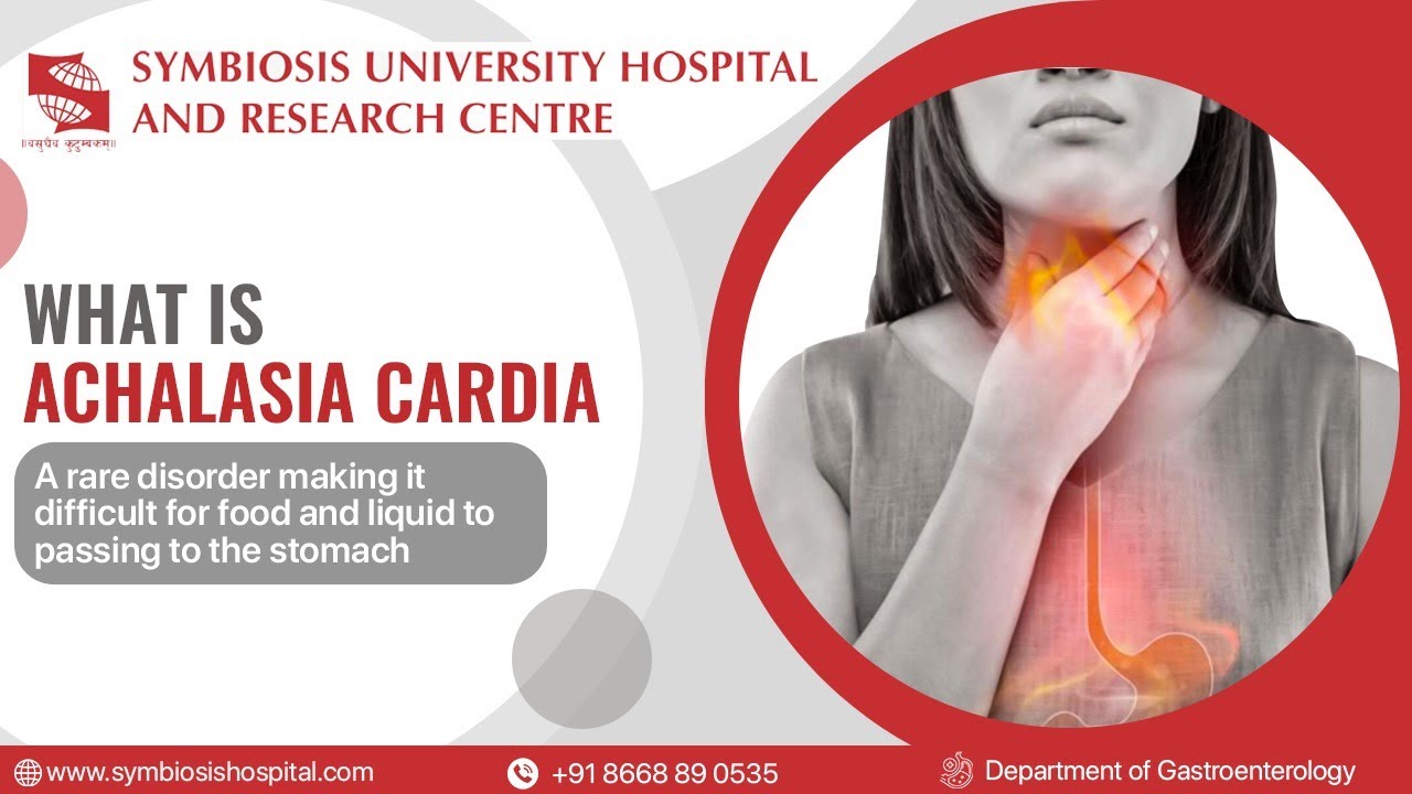 What is Achalasia Cardia - By Dr. Samrat Jankar - YouTube