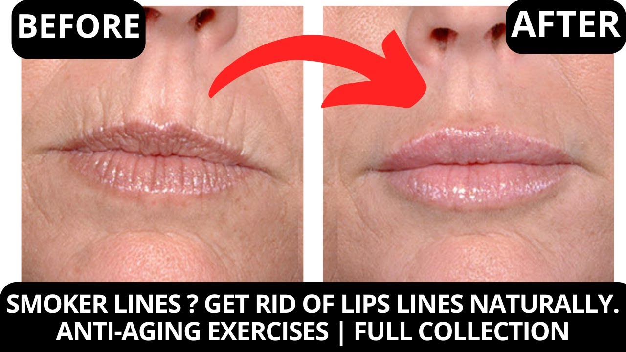 SMOKER LINES ? ANTI-AGING EXERCISES FOR WRINKLES AROUND MOUTH ! LIPS ...