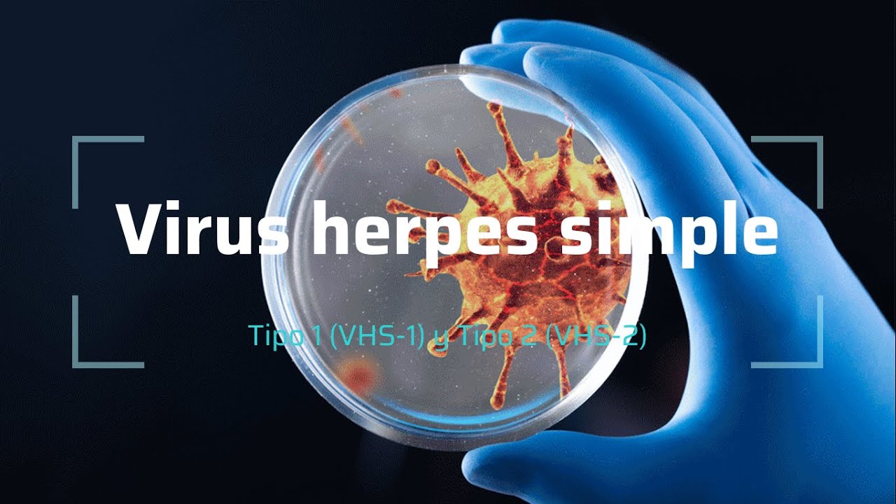 Virus del herpes simple VHS-1 y VHS-2 - YouTube