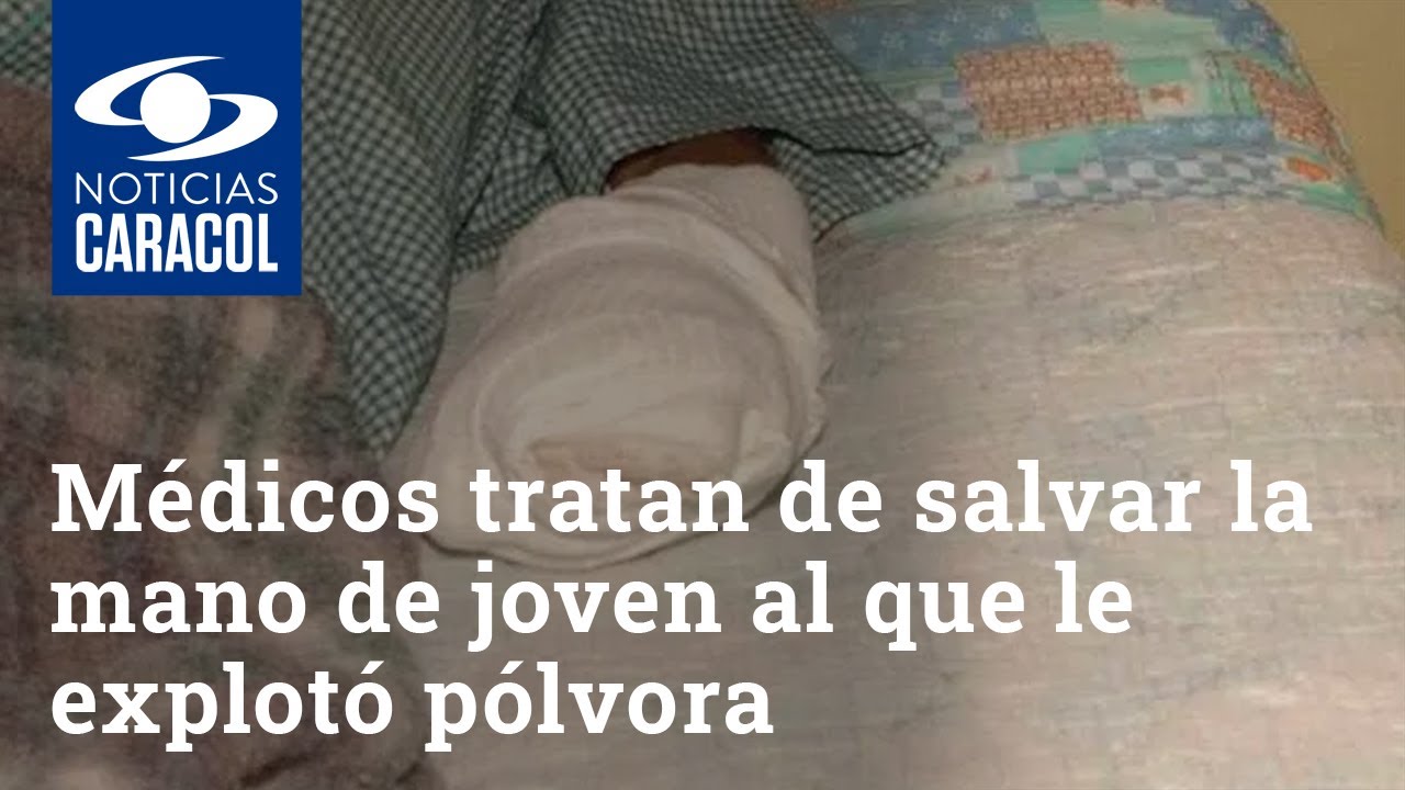 Médicos tratan de salvar la mano de joven de 16 años al que le explotó ...