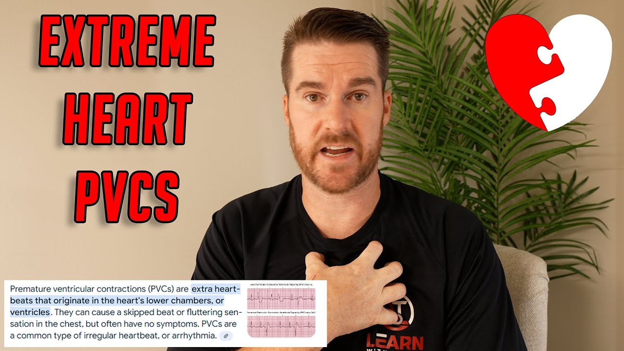 My Extreme Heart PVC Journey - Multiple Surgeries and How I Feel Now ...