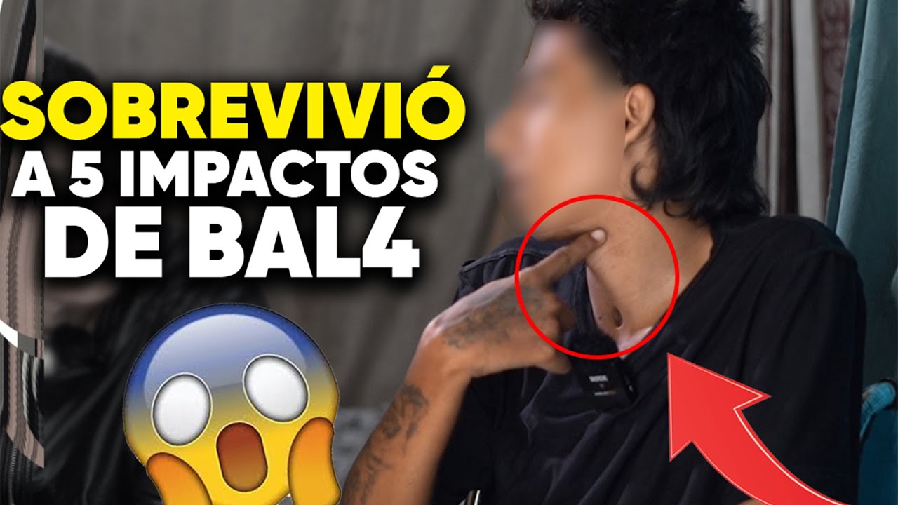 EL JOVEN QUE SOBREVIVIÓ A 5 IMPACTOS DE BALA 😱😔 - YouTube