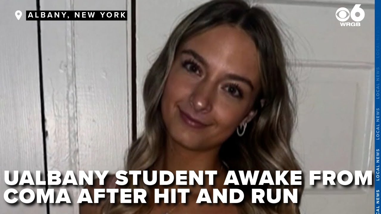 UAlbany student Alexa Kropf awake from coma following hit and run - YouTube