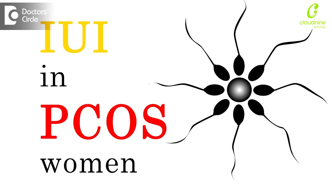 Is IUI difficult in women with PCOS?|Infertility in PCOS|Infertility in ...