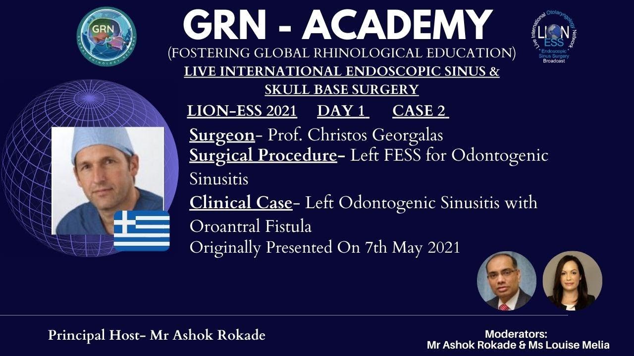 GRN ACADEMY- 5TH LION-ESS 2021 CASE 2- Left FESS for Odontogenic ...