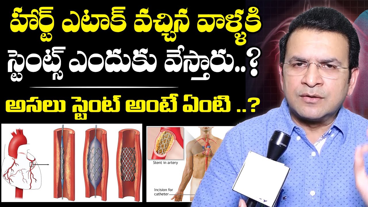 Dr. Movva Srinivas Cardiologist Explains The Importance Of Stents ...