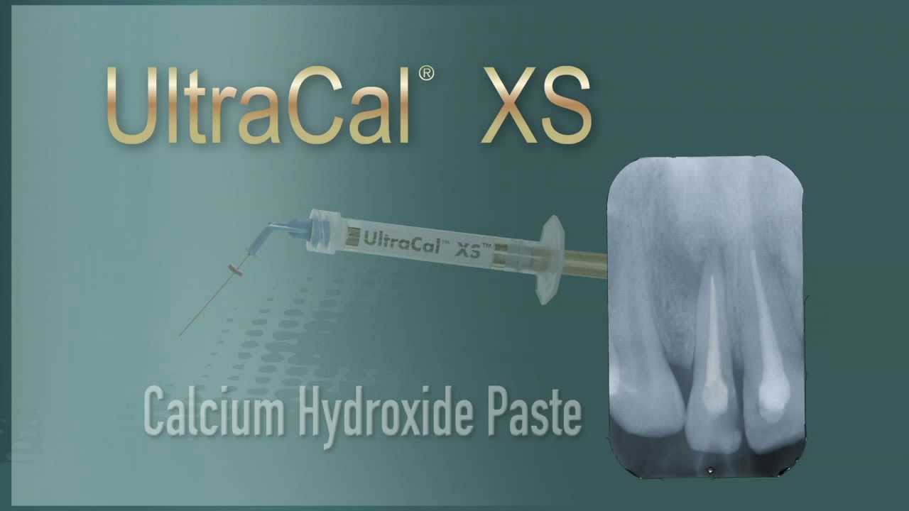 UltraCal XS - YouTube
