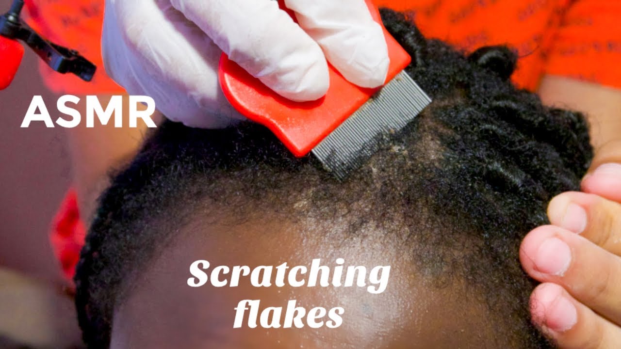 ASMR Scratching Flakes On Braids With Lice Comb - YouTube