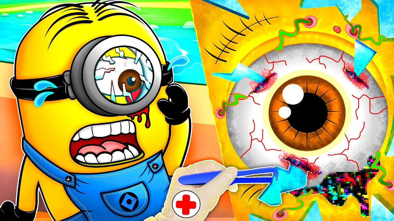 S .O .S! STUART MINION Eye Scratched 😫 How Does He Hurt? || Despicable ...