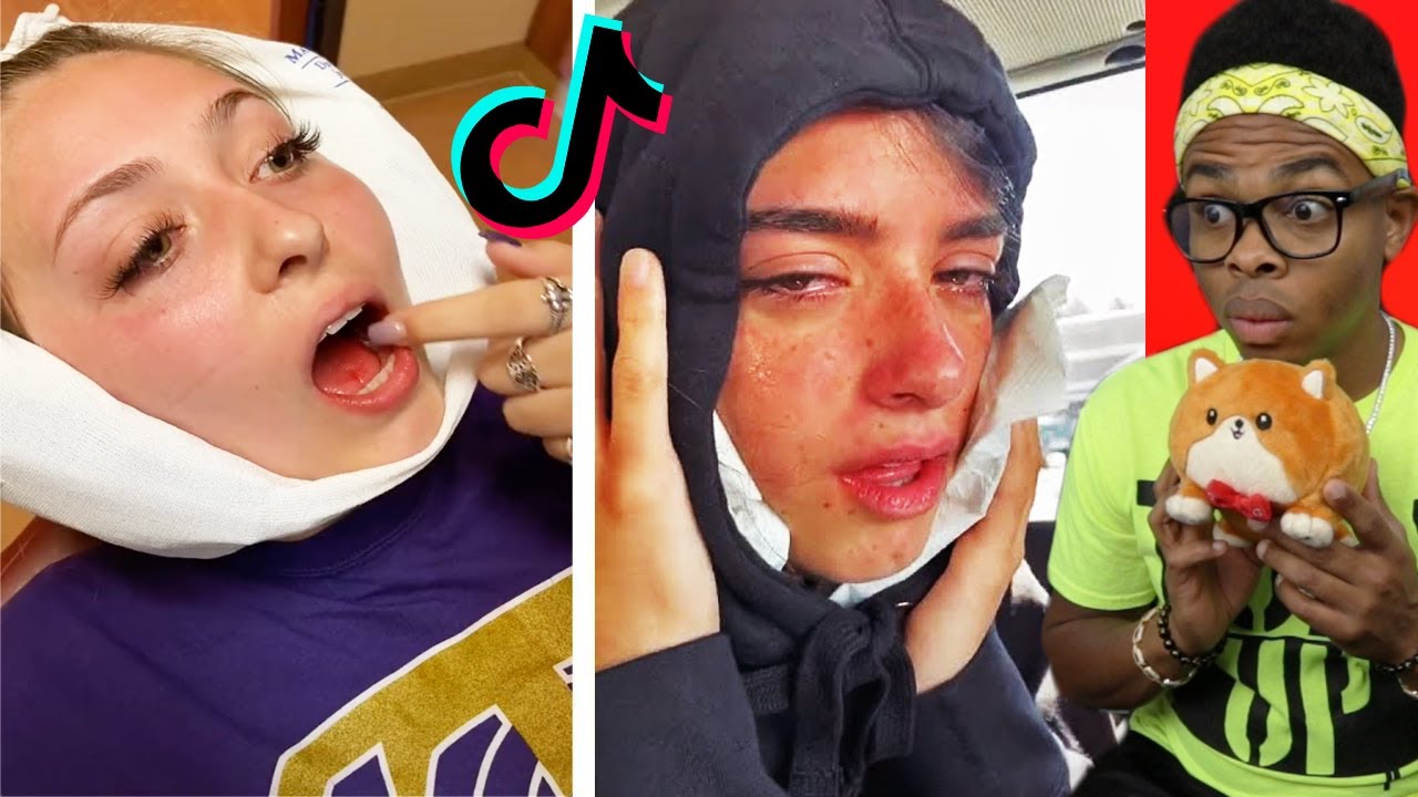 Funniest Wisdom Teeth Removal Tik Toks - YouTube