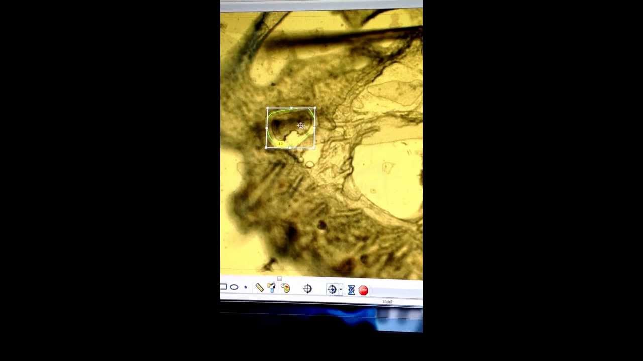 Zeiss PALM MicroBeam IV laser capture micro dissection system catapult ...