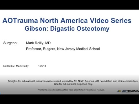Hip Digastric Osteotomy via Gibson Approach - YouTube