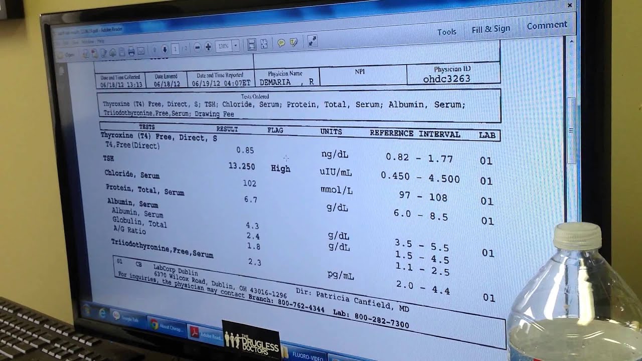 TSH T3 T4 Exam Explaining Results YouTube tsh-t3-t4-exam-explaining-results-youtube
