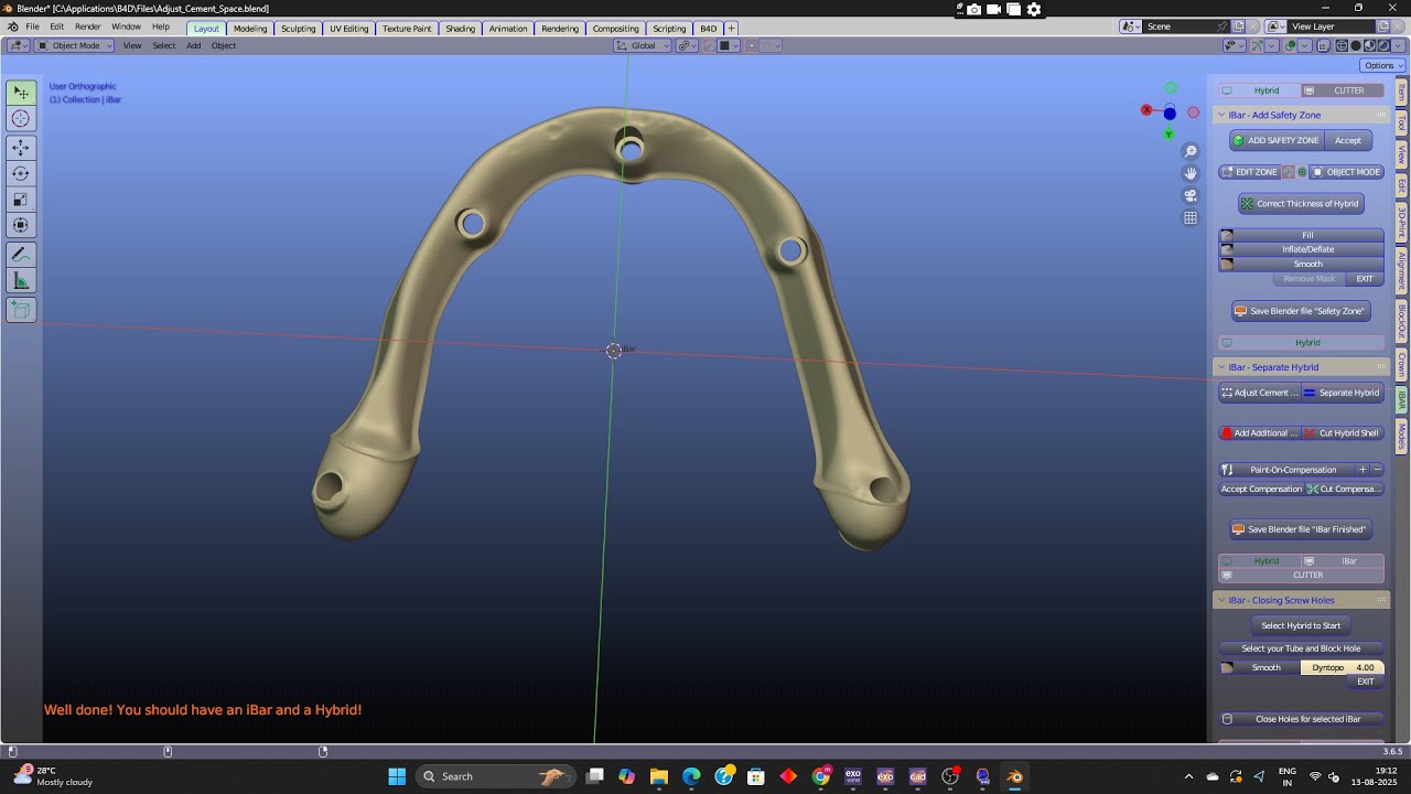 Screw retained bar designing for upper mu implants in exocad elefsina ...