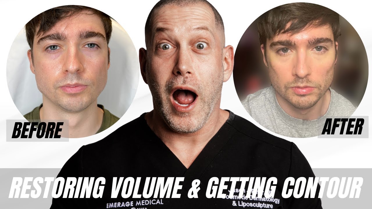 The Secret to a Sculpted & Youthful Face | Dr. Jason Emer - YouTube