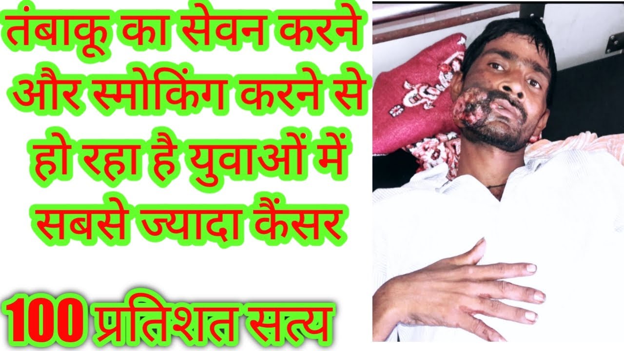 धूम्रपान करने से कैसे होता है कैंसर, Dhumrapan Karne Se Kaise Hota Hai ...