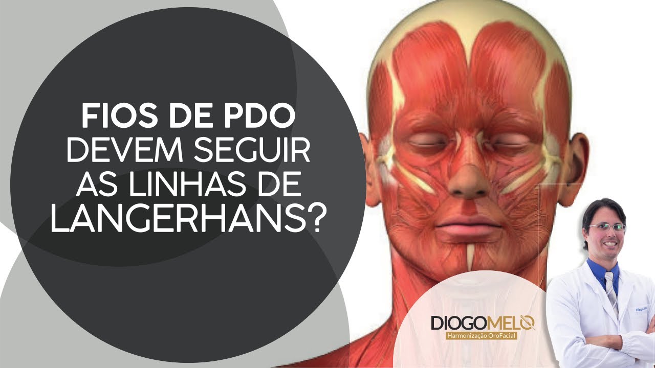 Os Fios de PDO devem seguir as Linhas de Langerhans? - YouTube