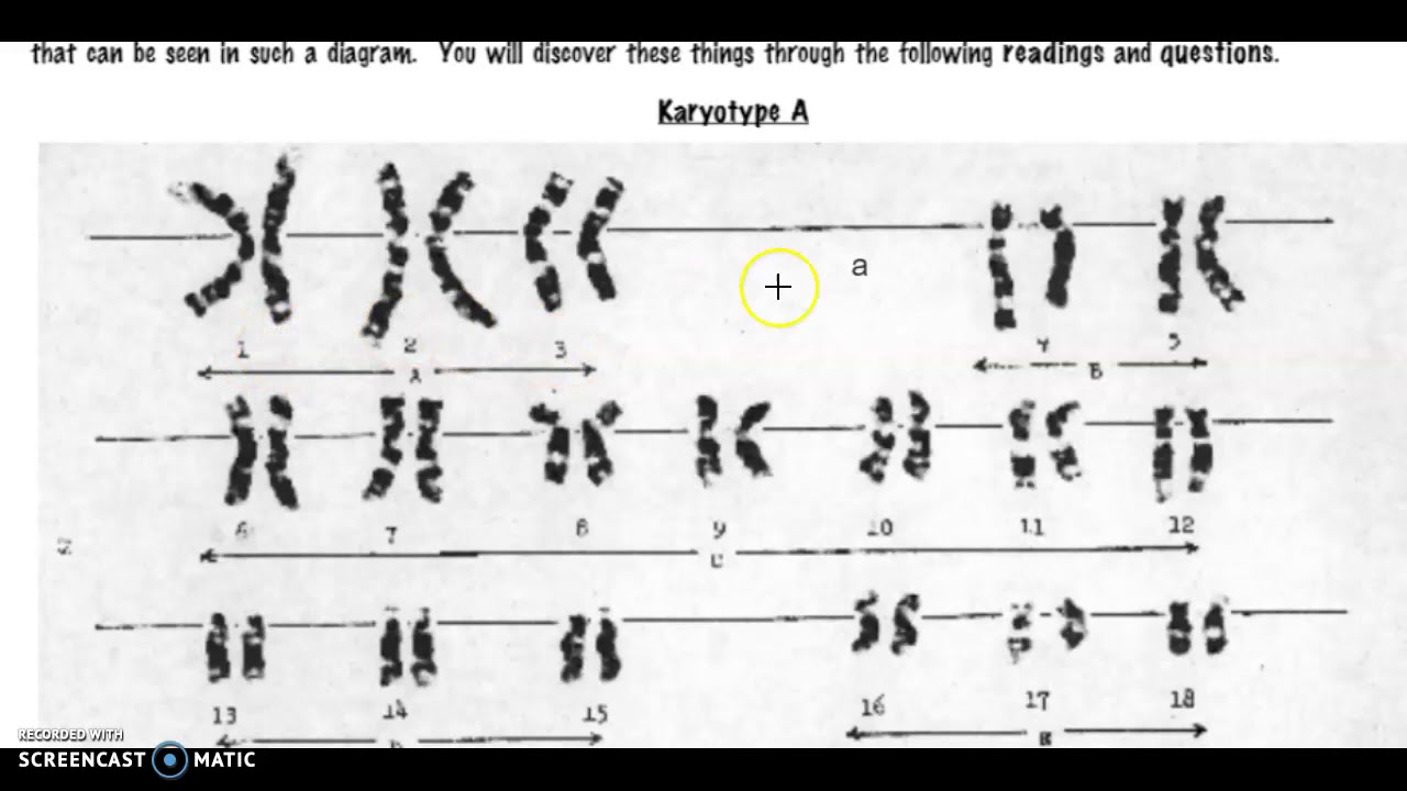 Reading Karyotypes Practice Ms. P Teach Me - YouTube