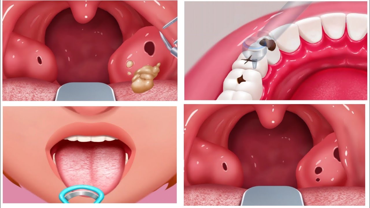 Deep cleaning and mouth wash animation - YouTube