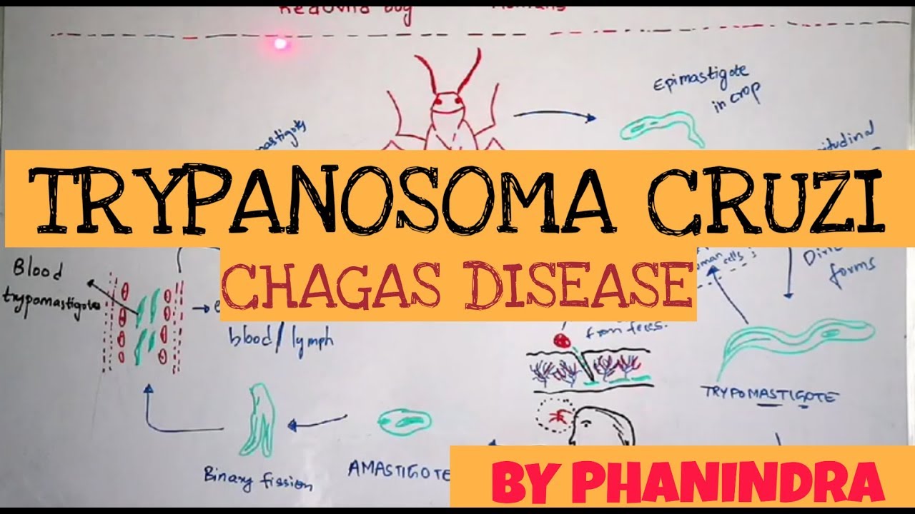 CHAGAS DISEASE || TRYPANOSOMA CRUZI || STRUCTURE || LIFE CYCLE ...