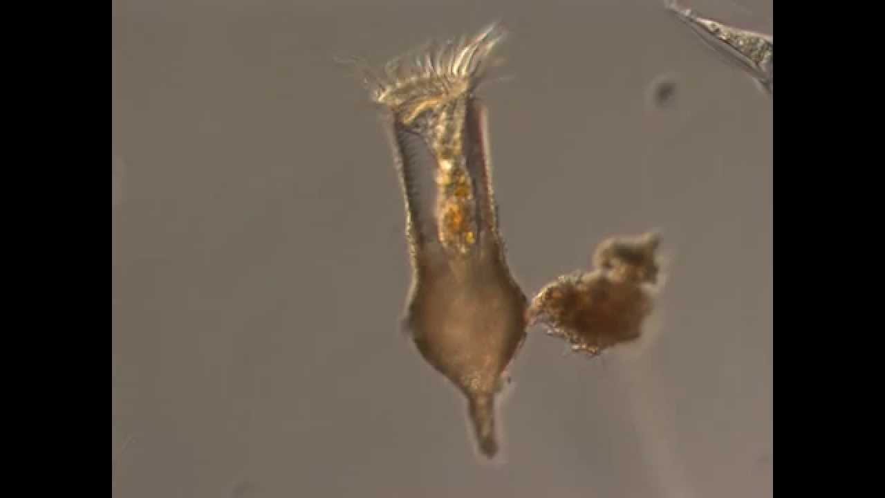 marine tintinnid ciliate Codonellopsis orthoceras - YouTube