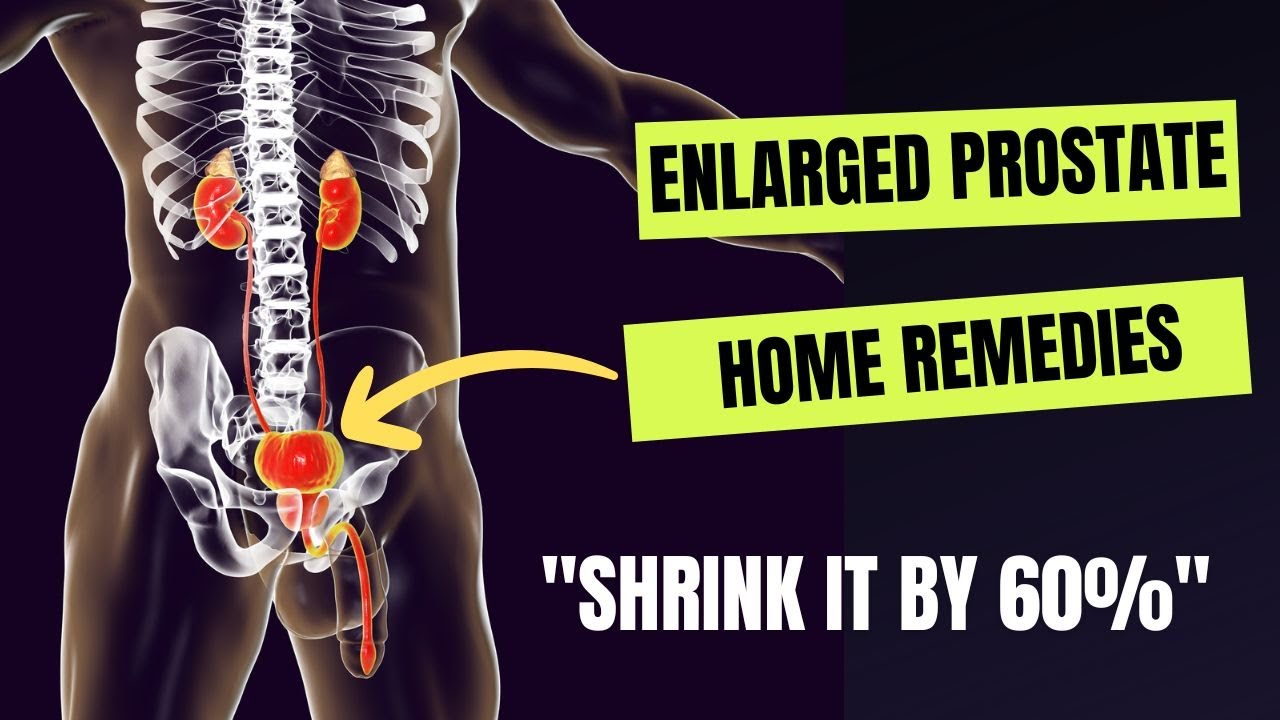 Home Remedies For Enlarged Prostate Problems (KNOW THESE NOW) - YouTube