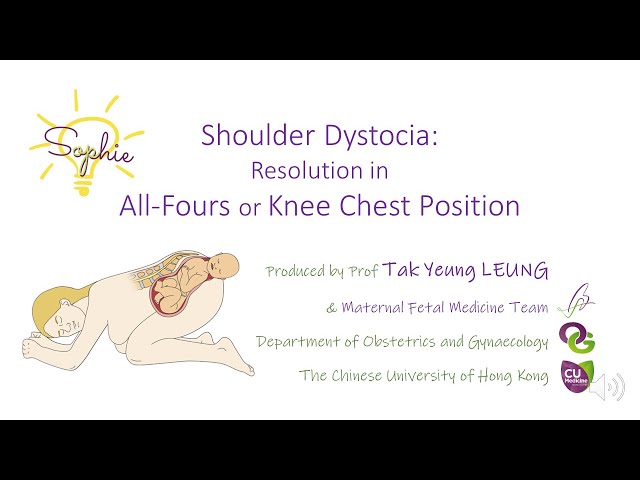 Knee Chest Positions
