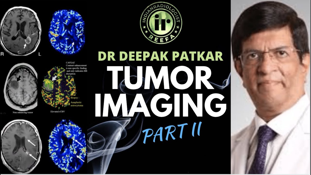 ADVANCES IN TUMOR IMAGING - II | DR DEEPAK PATKAR | DIFFUSION TENSOR ...