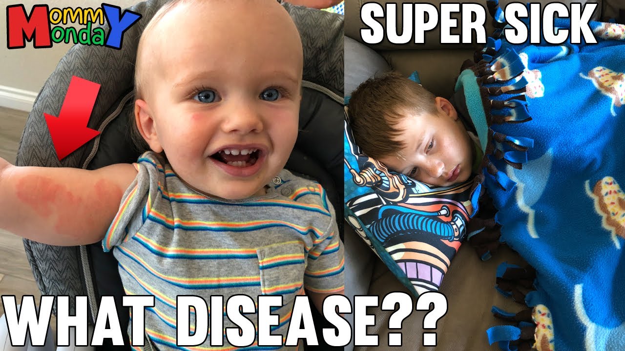 He Has a Disease || Mommy Monday - YouTube