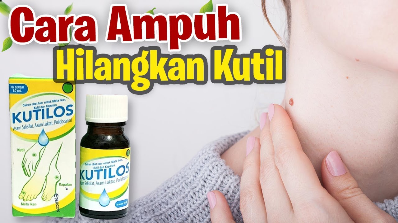 LEBIH MANJUR ! Begini Cara Pakai Kutilos Untuk Menghilangkan Kutil ...