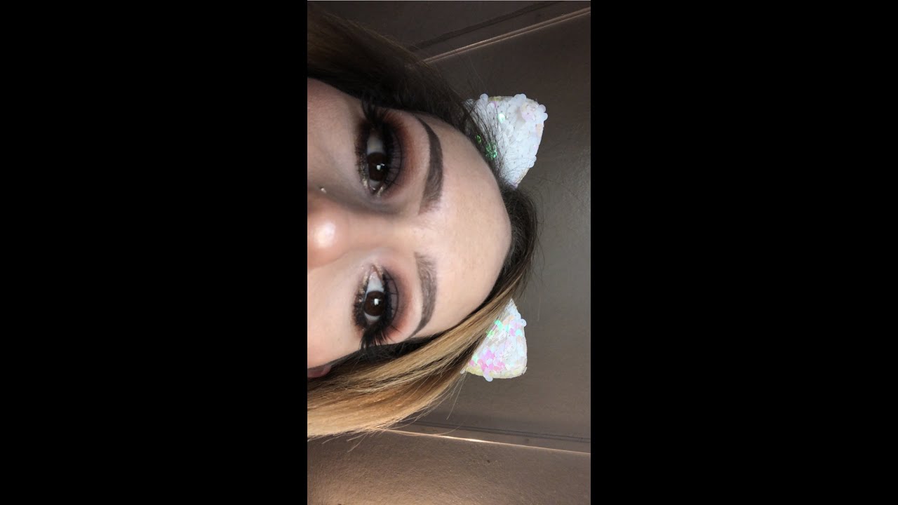 How I really feel about my new lip supporting snap in dentures🤨(I’m ...