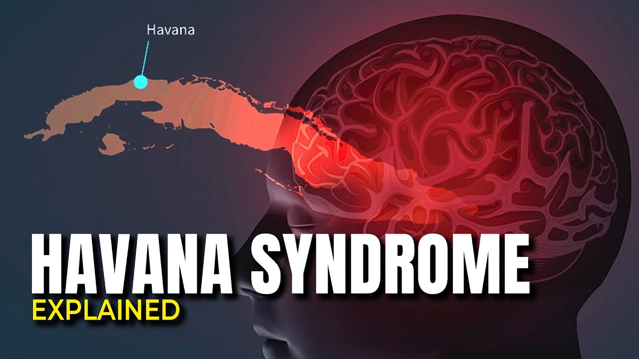 Havana Syndrome: Who is Behind the Invisible Weapon? - YouTube