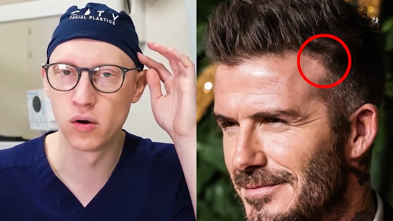 Best Hairstyle To Hide Early Hair Loss Dr Gary Linkov Youtube