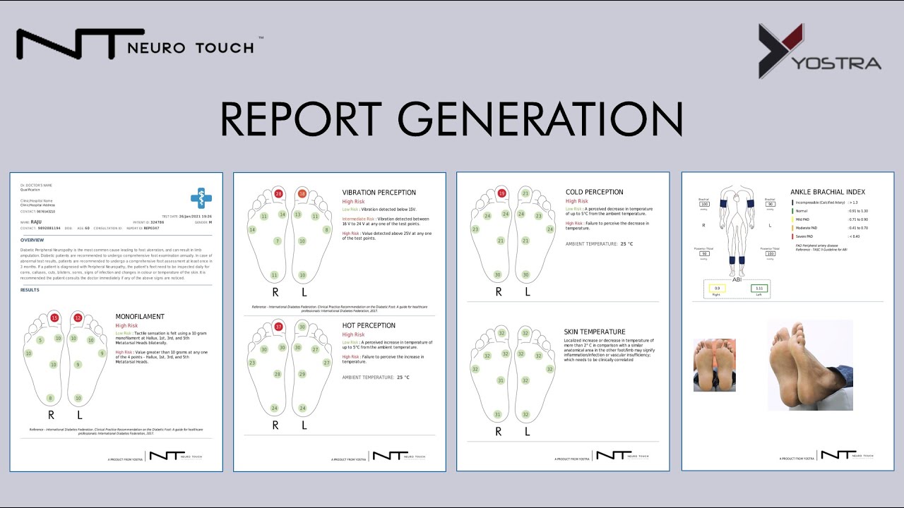 NEURO TOUCH™ Generating Reports - YouTube