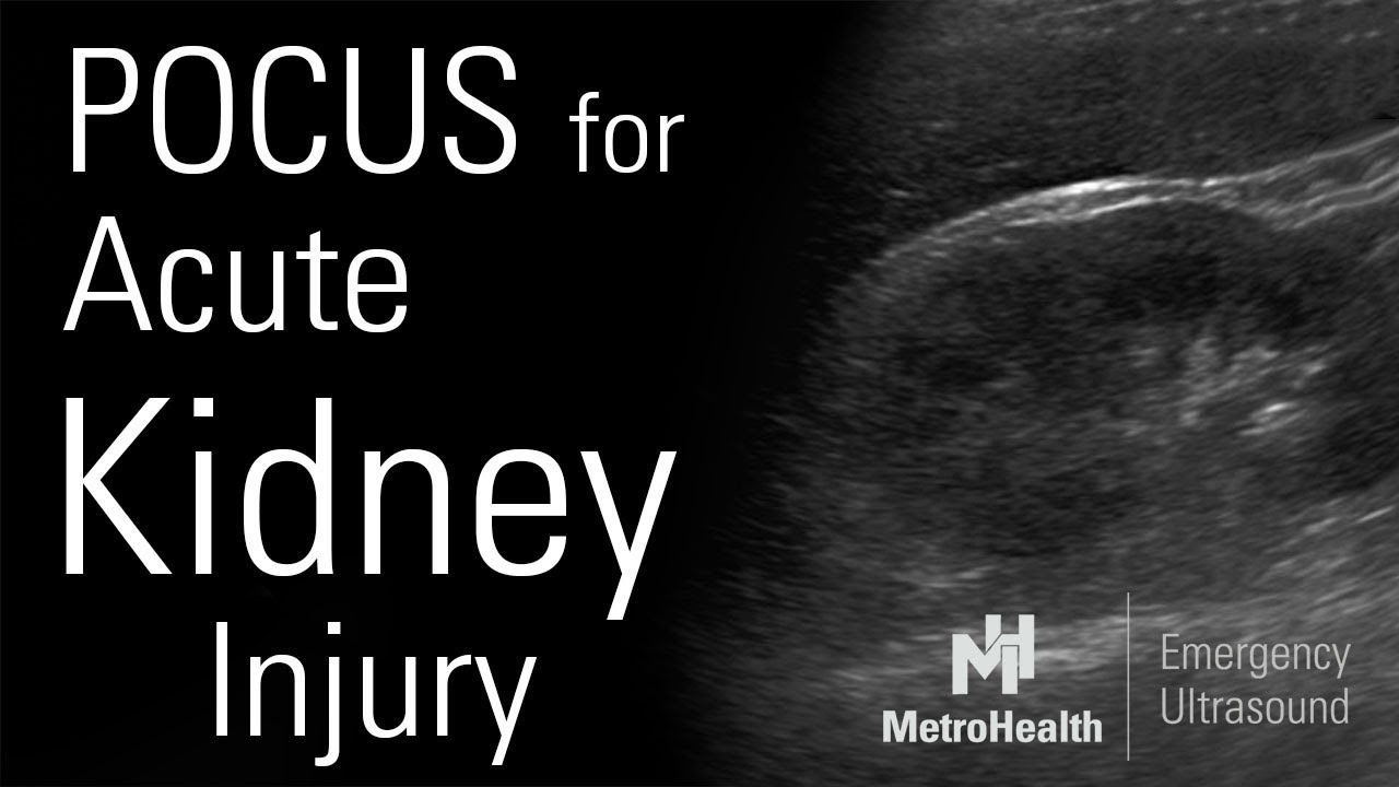 POCUS in Acute Kidney Injury - YouTube