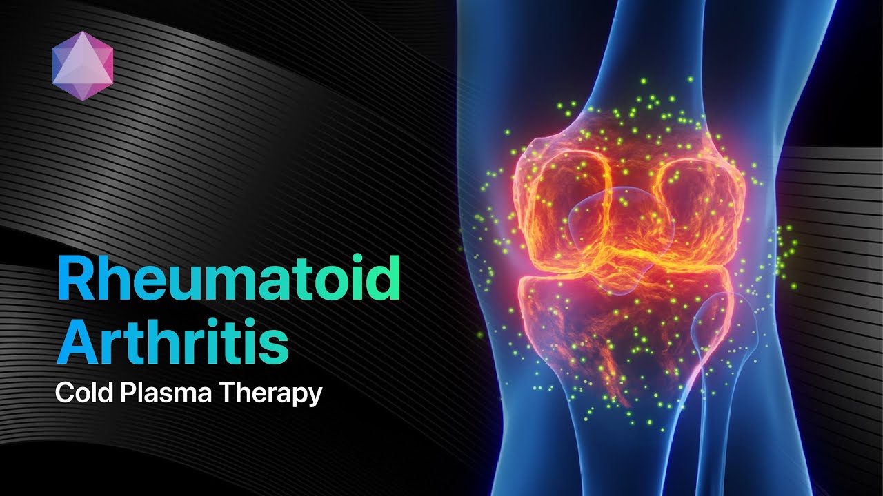 Combating Rheumatoid Arthritis - A New Hope with Cold Plasma Therapy ...