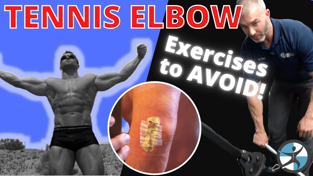 What Exercises To Avoid With Tennis Elbow
