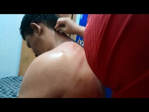 salah bantal???leher sakit!!!! kerokan terbaru #kerokan #kerikan #masukberanda