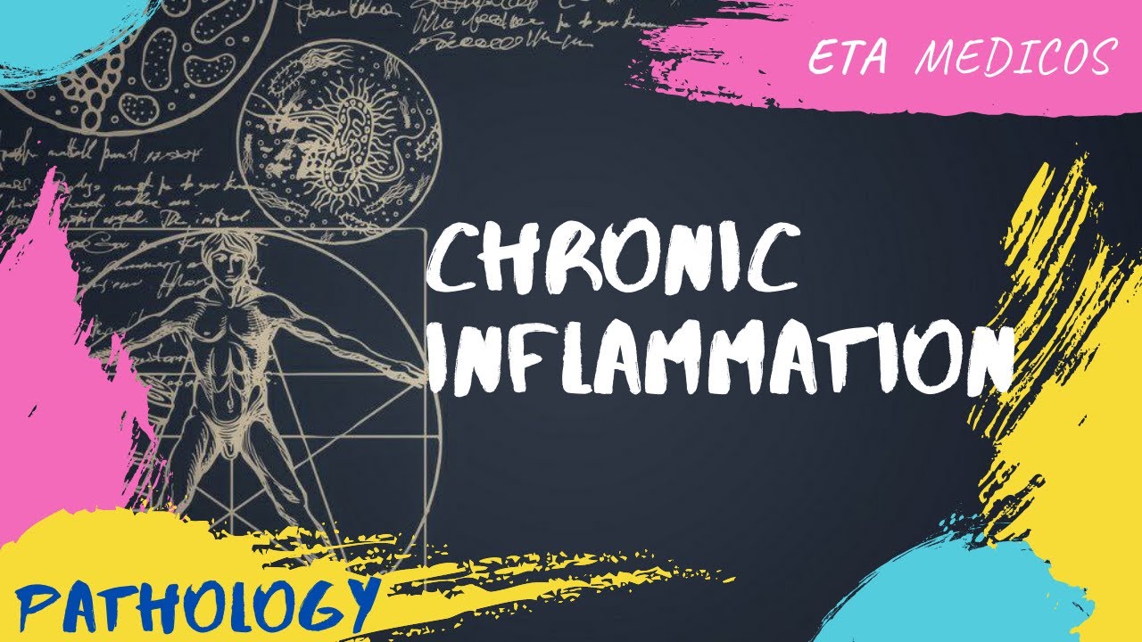 Chronic Inflammation Part 1 Explained In Sinhala YouTube chronic-inflammation-part-1-explained-in-sinhala-youtube