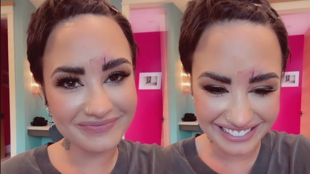 Demi Lovato Scratched Face